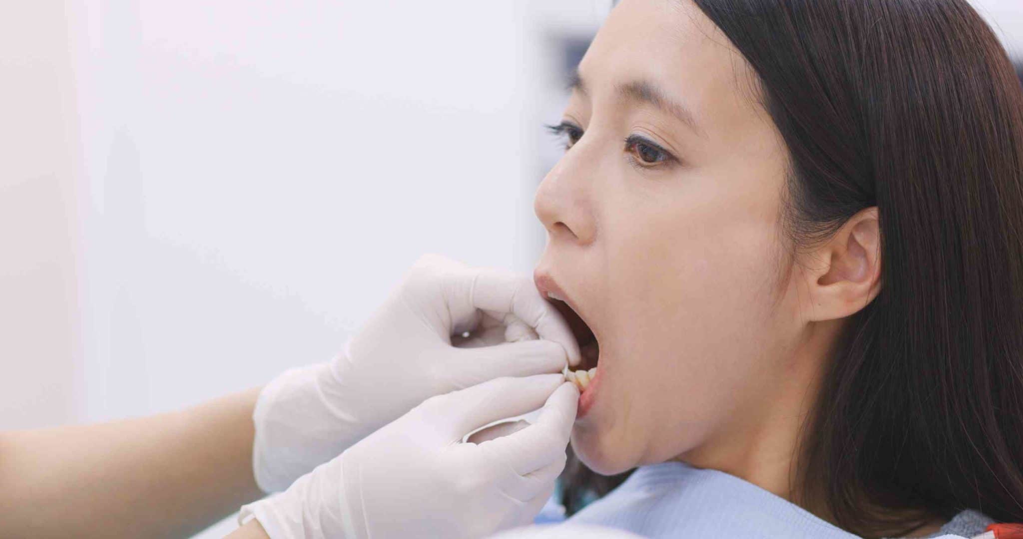 Why You Should Not Reuse Dental Floss | Dentistry | Anoka Denal, MN