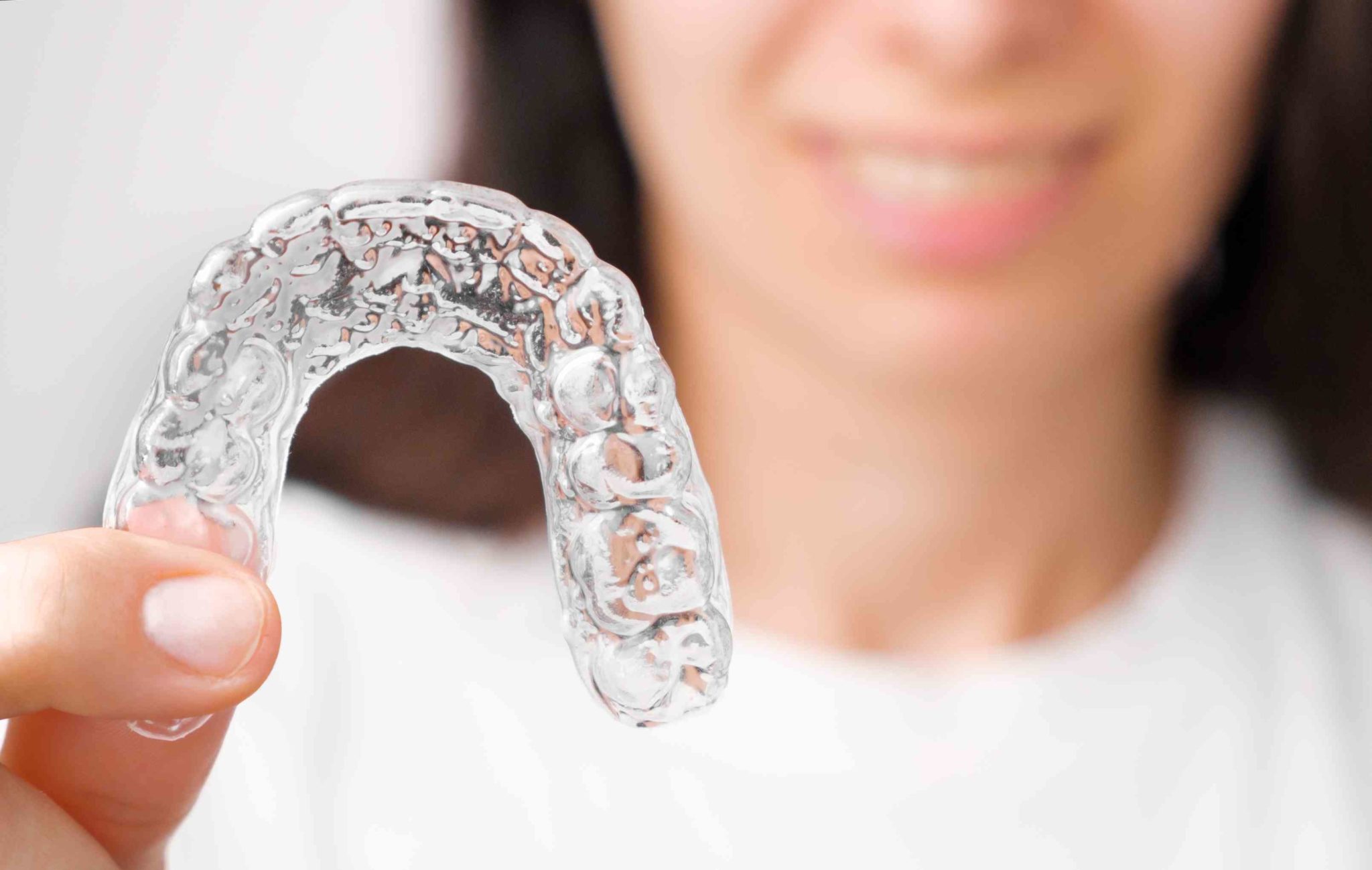 How Reveal Dental Aligners Work? Blog | Anoka Dental